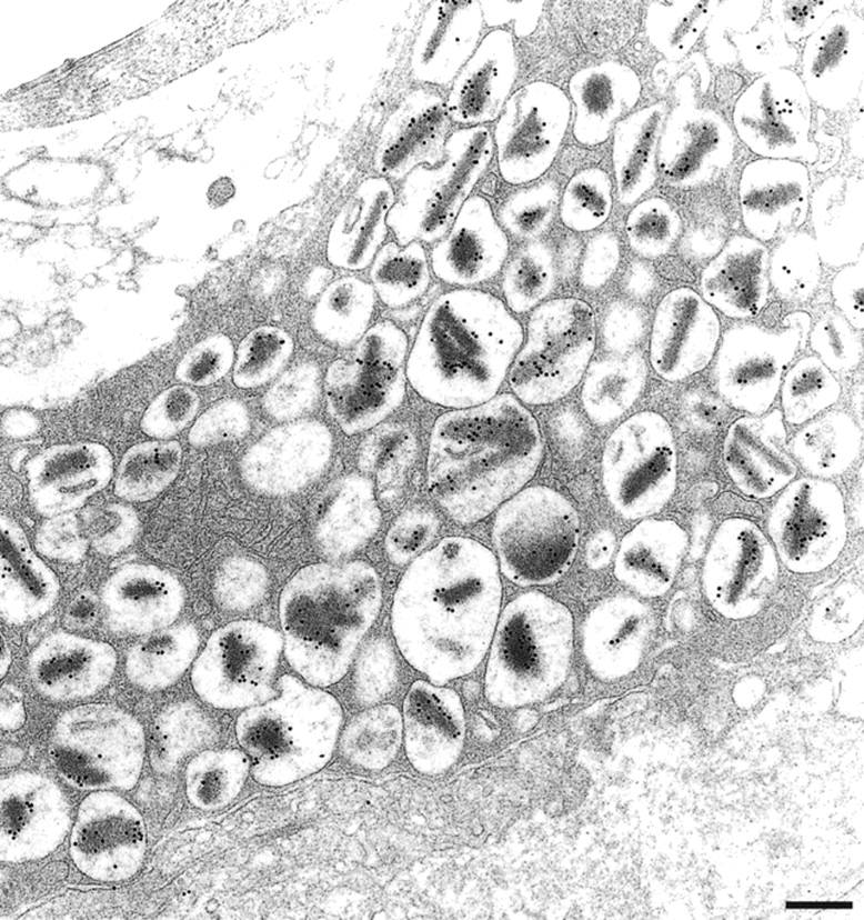 Immunogold Staining of Epoxy Resin Sections for Transmission Electron ...