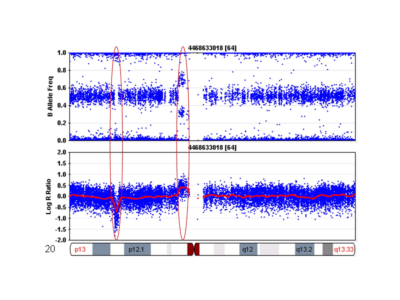 Copy Number Variation Detection via High-Density SNP Genotyping