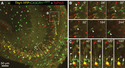 Imaging Microglia in Brain Slices and Slice Cultures