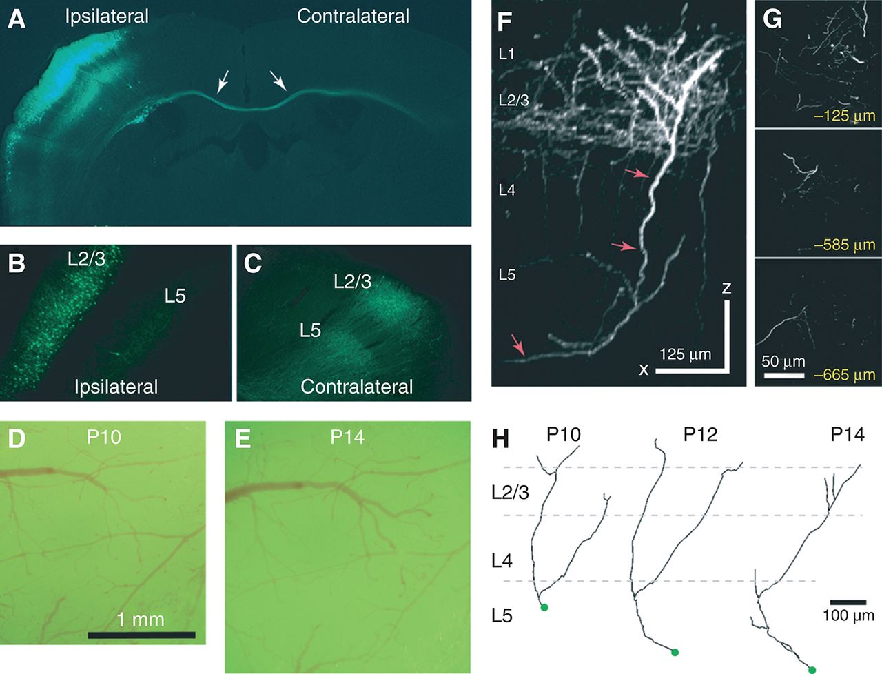 In Vivo Imaging of Axonal and Dendritic Structures in Neonatal Mouse Cortex