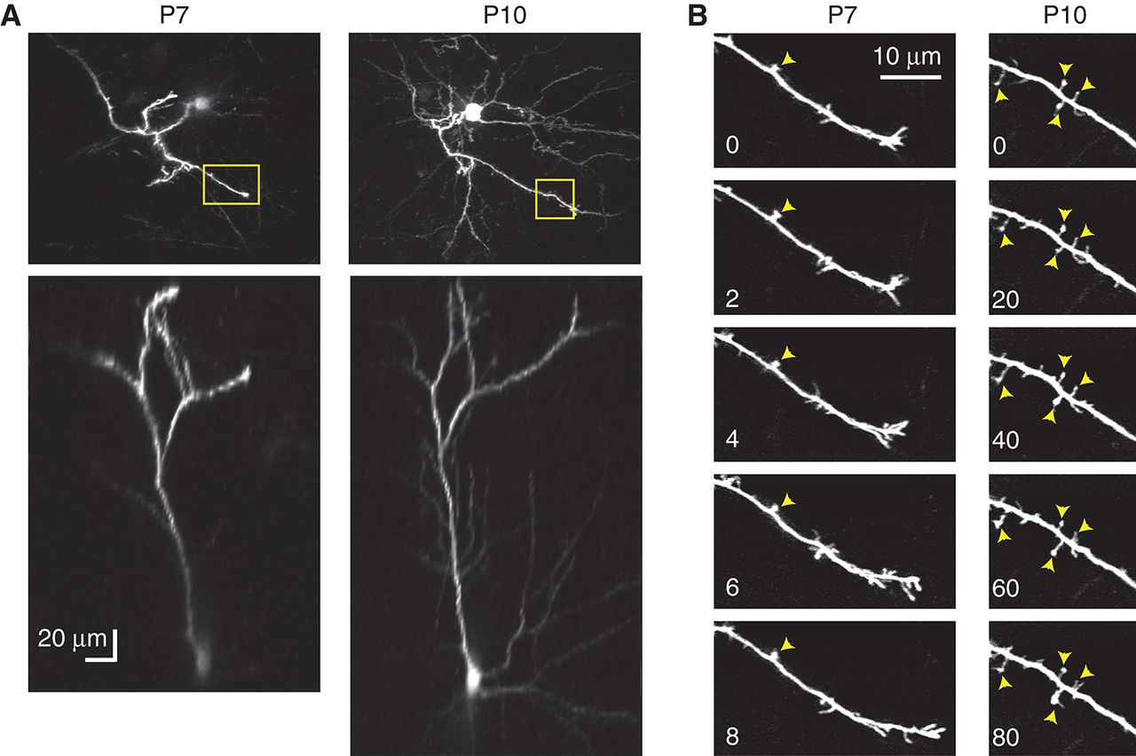 In Vivo Imaging of Axonal and Dendritic Structures in Neonatal Mouse Cortex