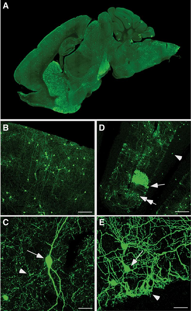 Genetic Labeling of Neurons in Mouse Brain
