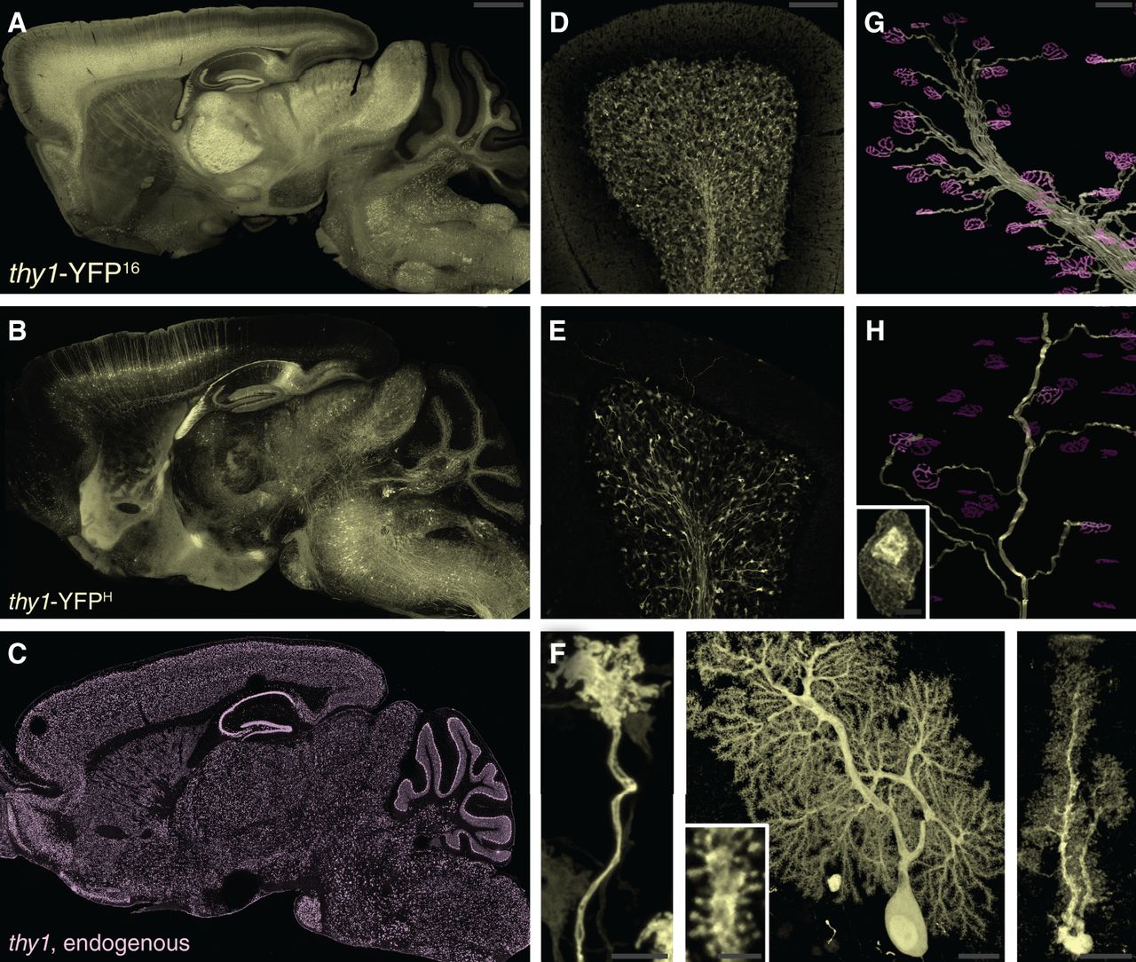 Generation and Screening of Transgenic Mice with Neuronal Labeling ...